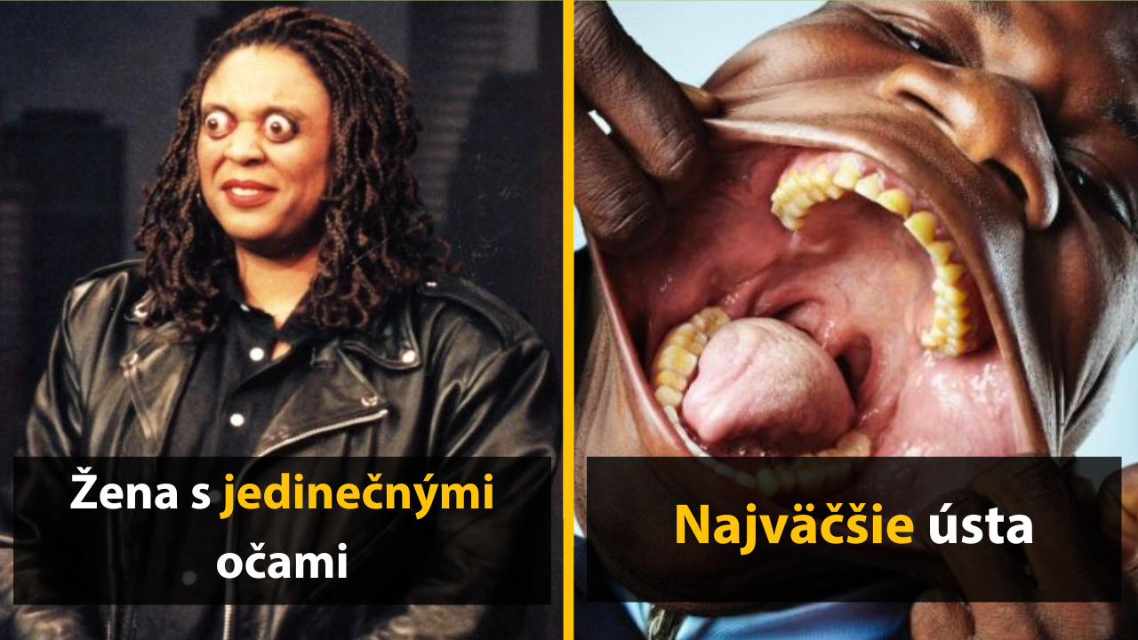 10 ľudí s mimoriadnymi fyzickými vlastnosťami, o ktorých neuveríte, že skutočne existujú