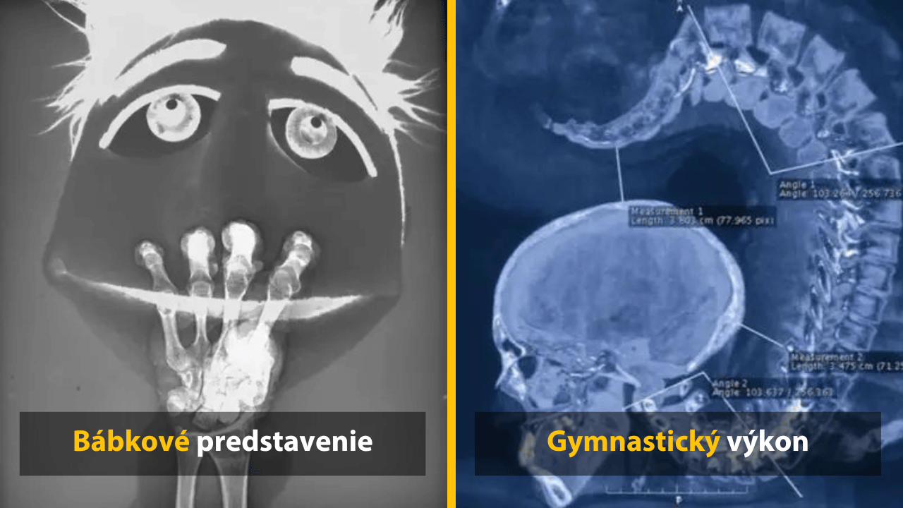 10 RTG snímok, ktoré v tebe zanechajú zmiešané pocity