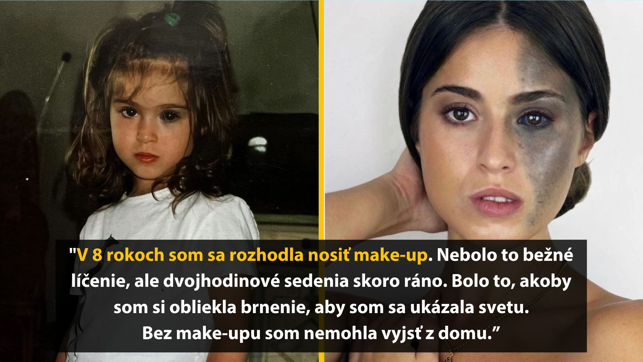 Modelka s obrovským materským znamienkom zdieľa svoju cestu k sebaláske
